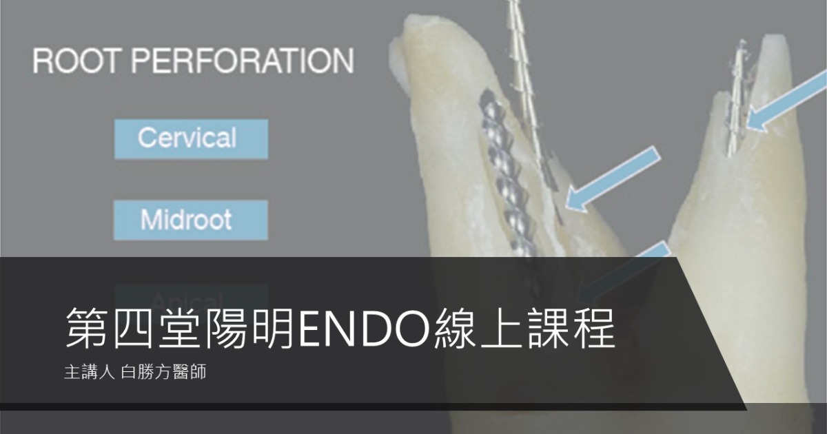 第四堂陽明endo線上課程（Procedure errors in root canal treatment-perforation）